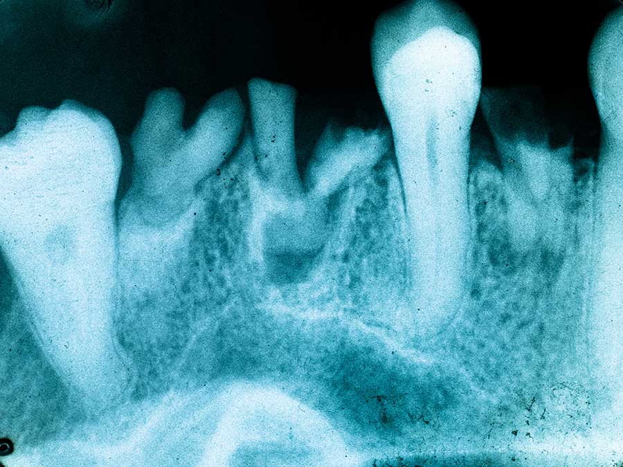Recent Advances in Head, Neck, and Oral Cancer Treatments » Portland ... Recent Advances in Head, Neck, and Oral Cancer Treatments » Portland ...